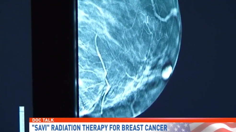 Doc Talk | "SAVI" radiation therapy for breast cancer | WHP